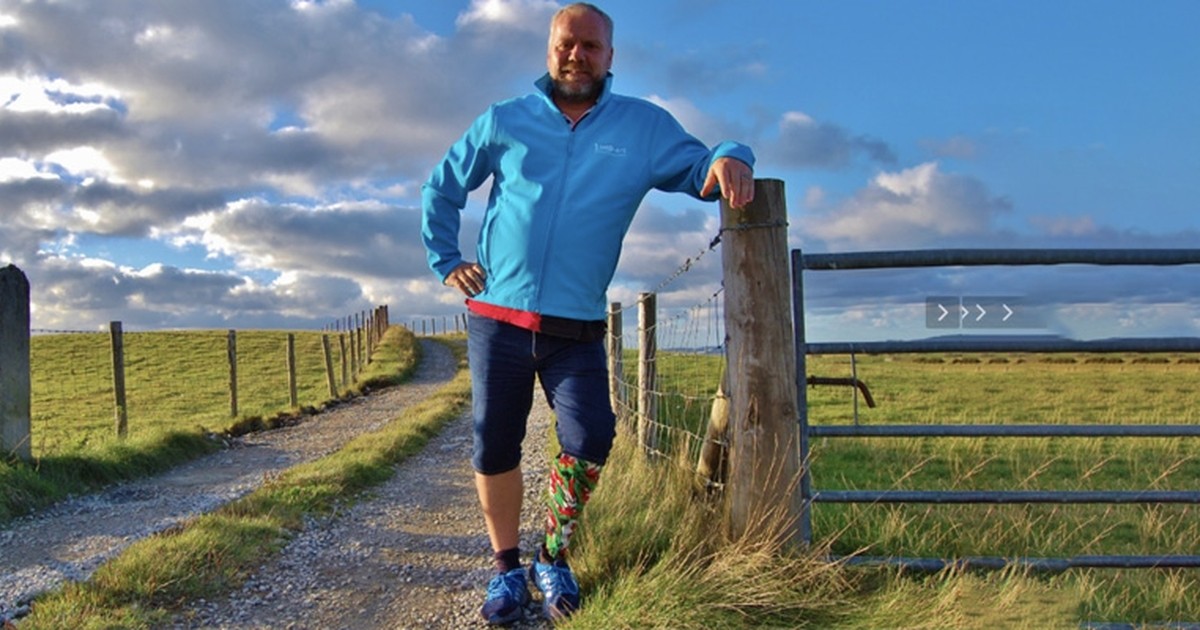 Exploring “cool” LIMB-art prosthetic leg covers’ impact on amputees and ...